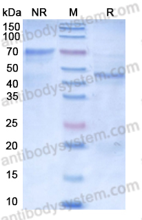 Buy Recombinant Human F10/Factor X Protein, C-His