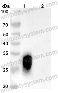Buy Anti-Human CD79β/CD79B Antibody (SAA0036)