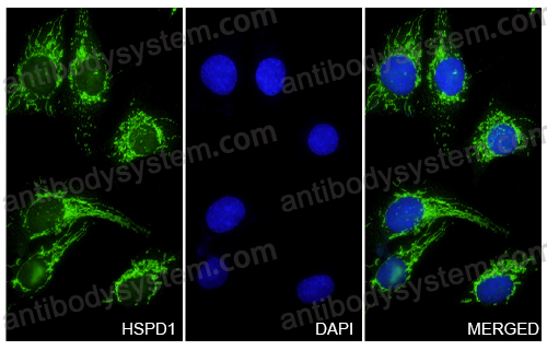 Buy Anti-HSPD1 Polyclonal antibody