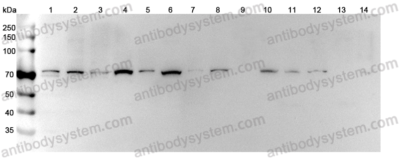 Buy Anti-PIK3R1 / PI3-kinase p85-alpha Polyclonal antibody