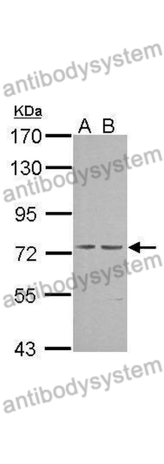 Buy Anti-Human PRKG1 Polyclonal Antibody