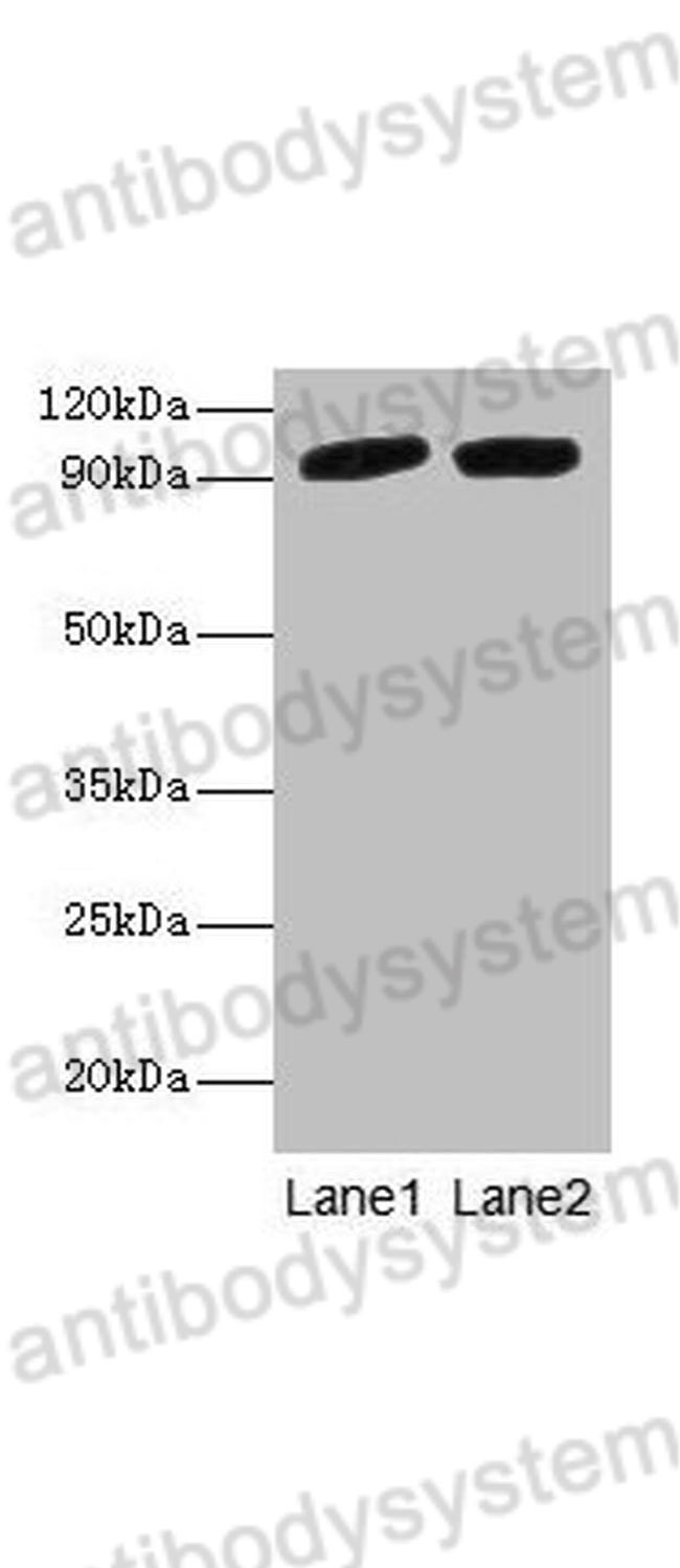 Buy Anti-Human POSTN Polyclonal Antibody