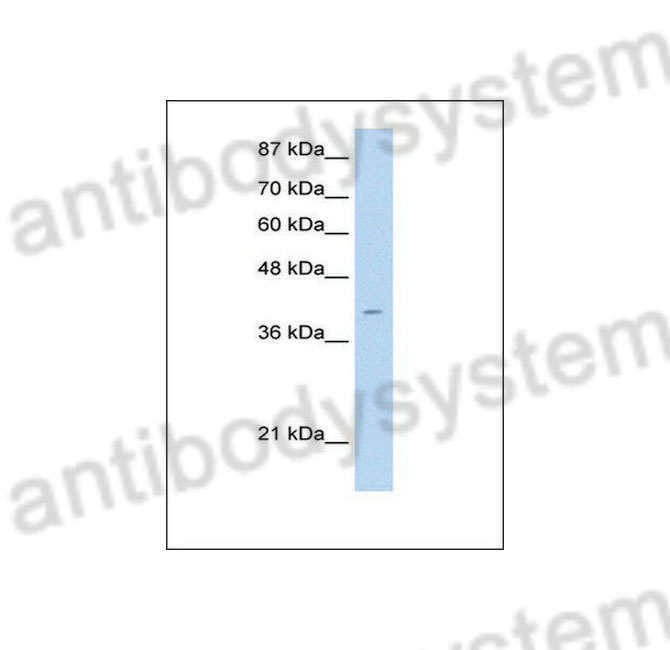 Buy Anti-Mouse RAGE/AGER Polyclonal Antibody