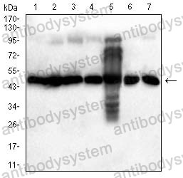 Anti-CD254/RANKL/TNFSF11 Antibody (R2T94)_AntibodySystem