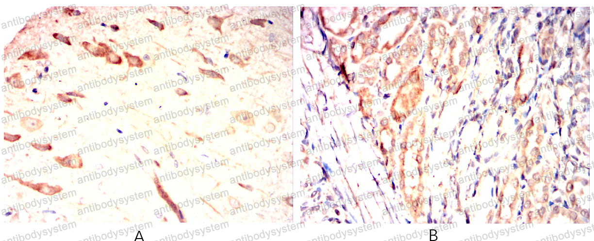 Anti-DCX Antibody (R2U96)_AntibodySystem