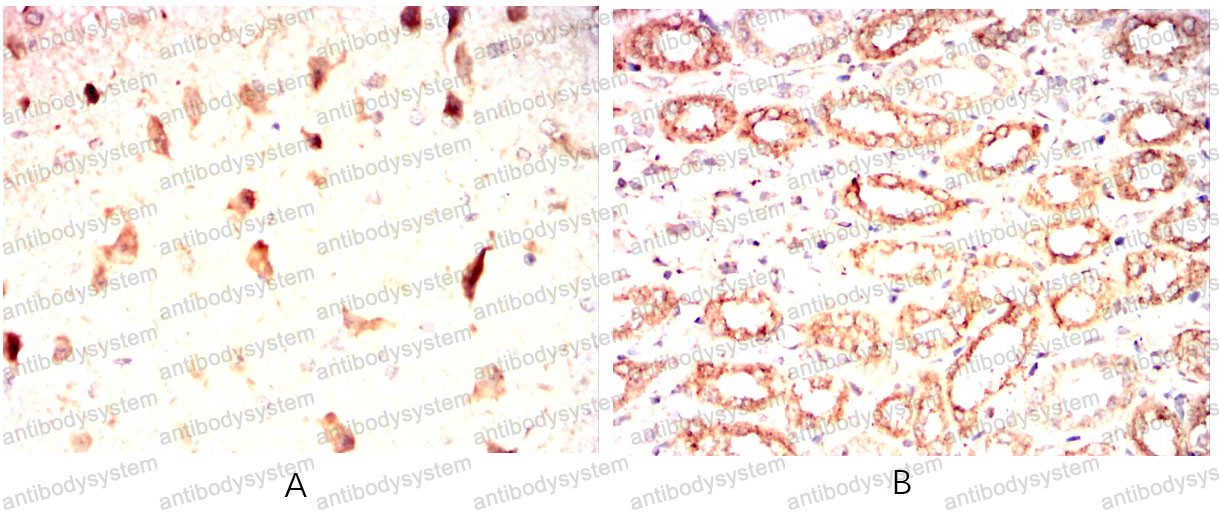 Anti-DCX Antibody (R2U96)_AntibodySystem