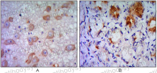 Anti-ERN1 Antibody (R2V70)_AntibodySystem