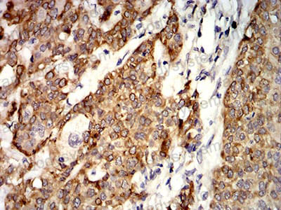 Anti-AGR2/HPC8 Antibody (R2W52)_AntibodySystem