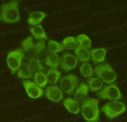 Anti-EIF2S1/eIF2A Antibody (R2Z15)_AntibodySystem