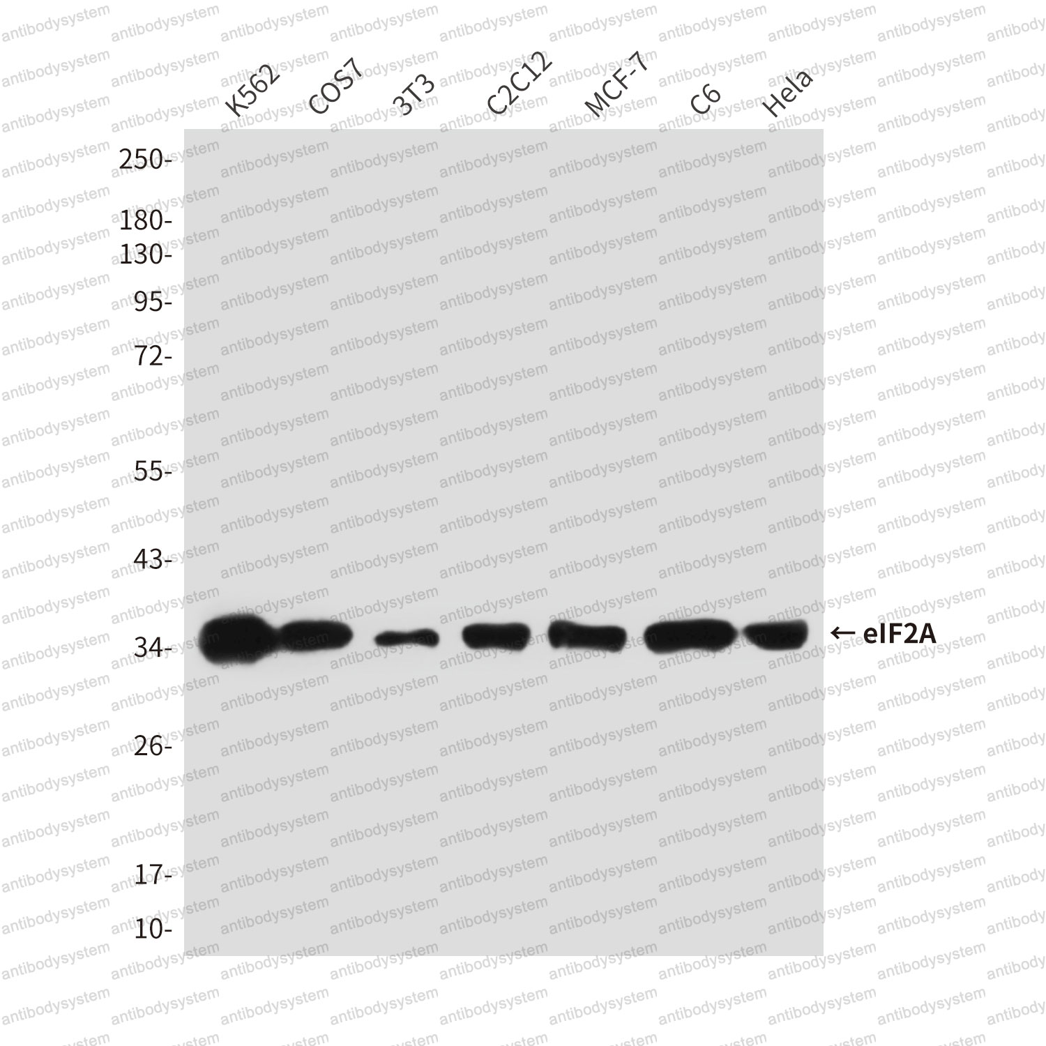 Anti-EIF2S1/eIF2A Antibody (R2Z15)_AntibodySystem