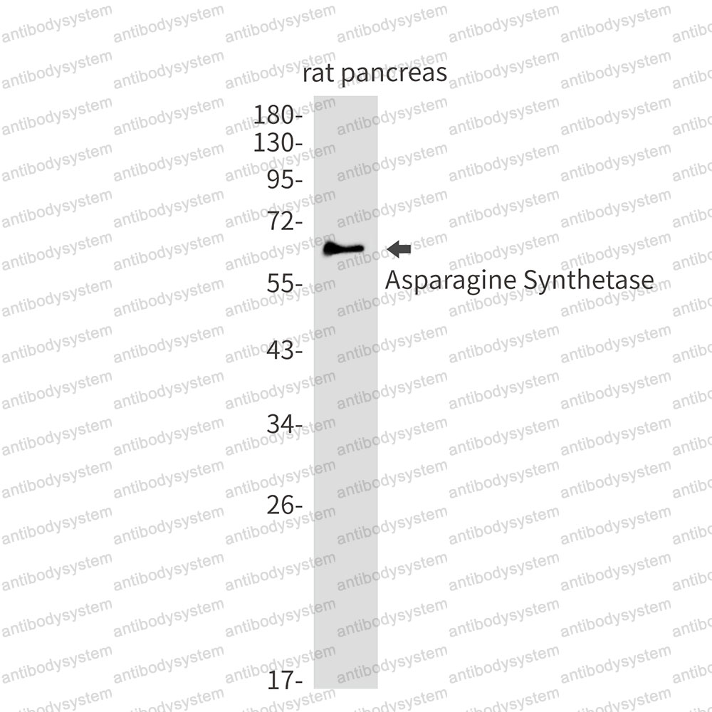 Anti-ASNS Antibody (R1L55)_AntibodySystem