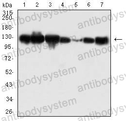 Anti-CD324/CDH1 Antibody (R3C98)_AntibodySystem