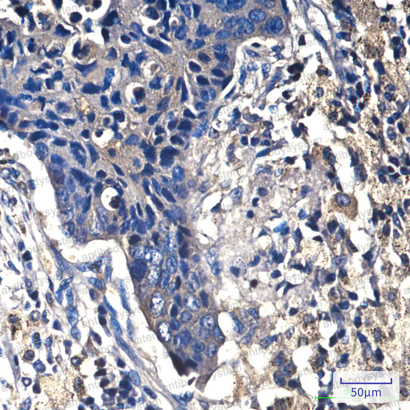 Anti-CTNNB1 Antibody (R3J69)_AntibodySystem