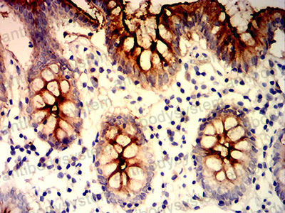 Anti-CD66c/CEACAM6 Antibody (R3K27)_AntibodySystem