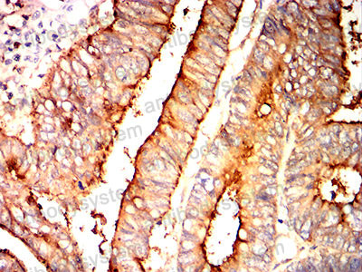 Anti-CD66c/CEACAM6 Antibody (R3K27)_AntibodySystem