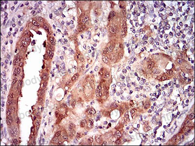Anti-CDKN2A/p16INK4a Antibody (R3K96)_AntibodySystem