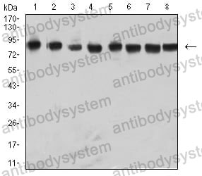 Anti-NAGR1/HNRNPM Antibody (R3M74)_AntibodySystem