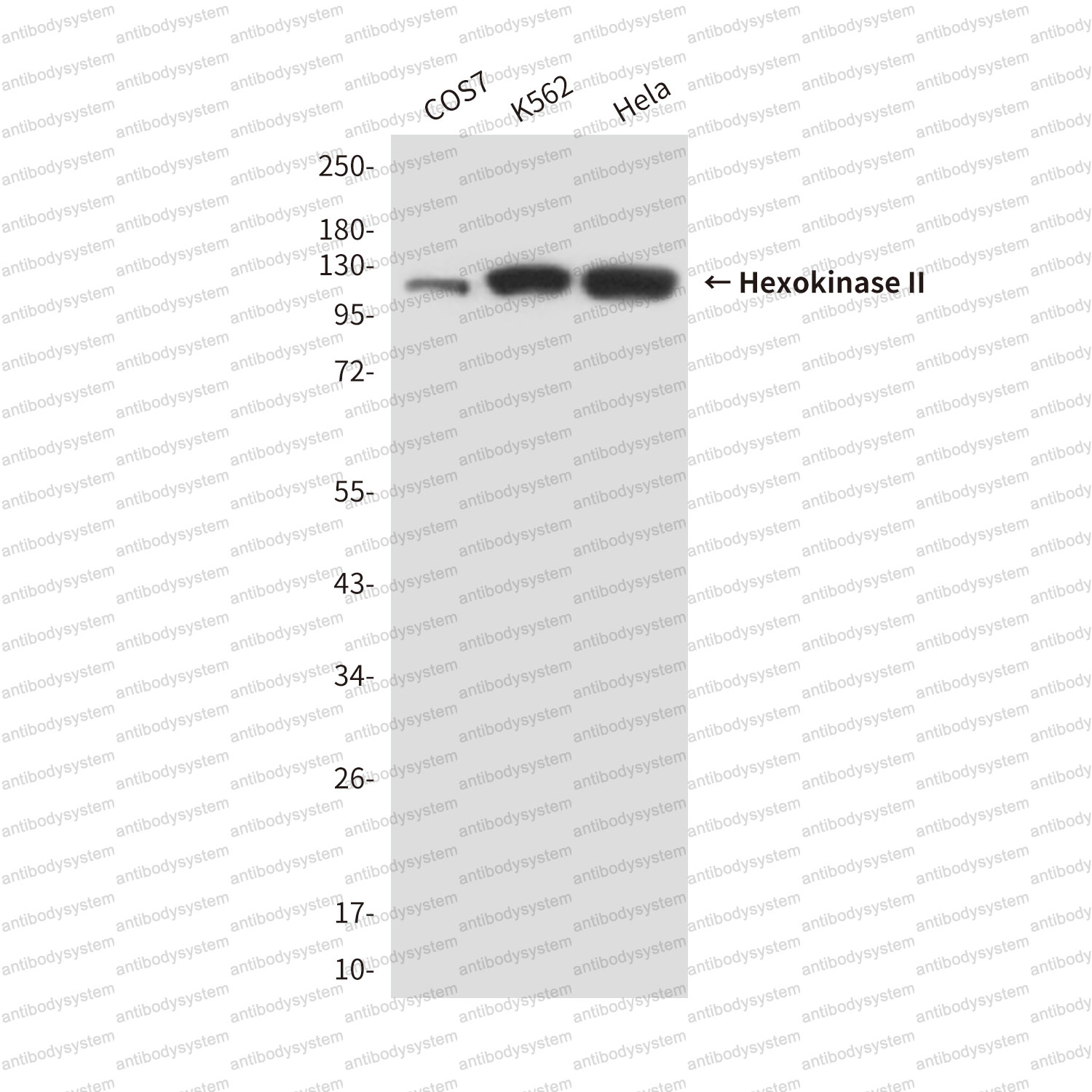 Anti-HK2 Antibody (R3M95)_AntibodySystem