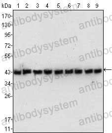 Anti-ACTB/β-actin/Beta Actin Antibody (R3N80)_AntibodySystem
