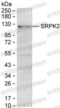 Anti-SRPK2 Antibody (R3P70)_AntibodySystem