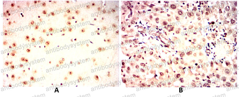 Anti-MEF2C Antibody (R3R26)_AntibodySystem