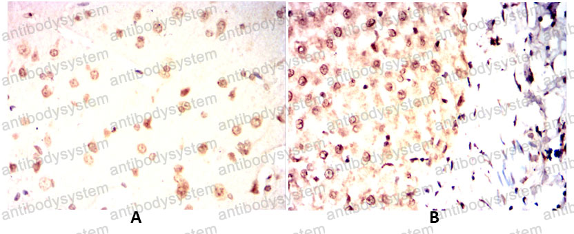 Anti-MEF2C Antibody (R3R26)_AntibodySystem