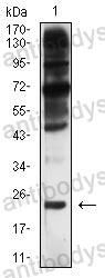 Anti-BAX Antibody (R3R53)_AntibodySystem