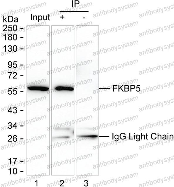 Anti-FKBP5 Antibody (R3S51)_AntibodySystem