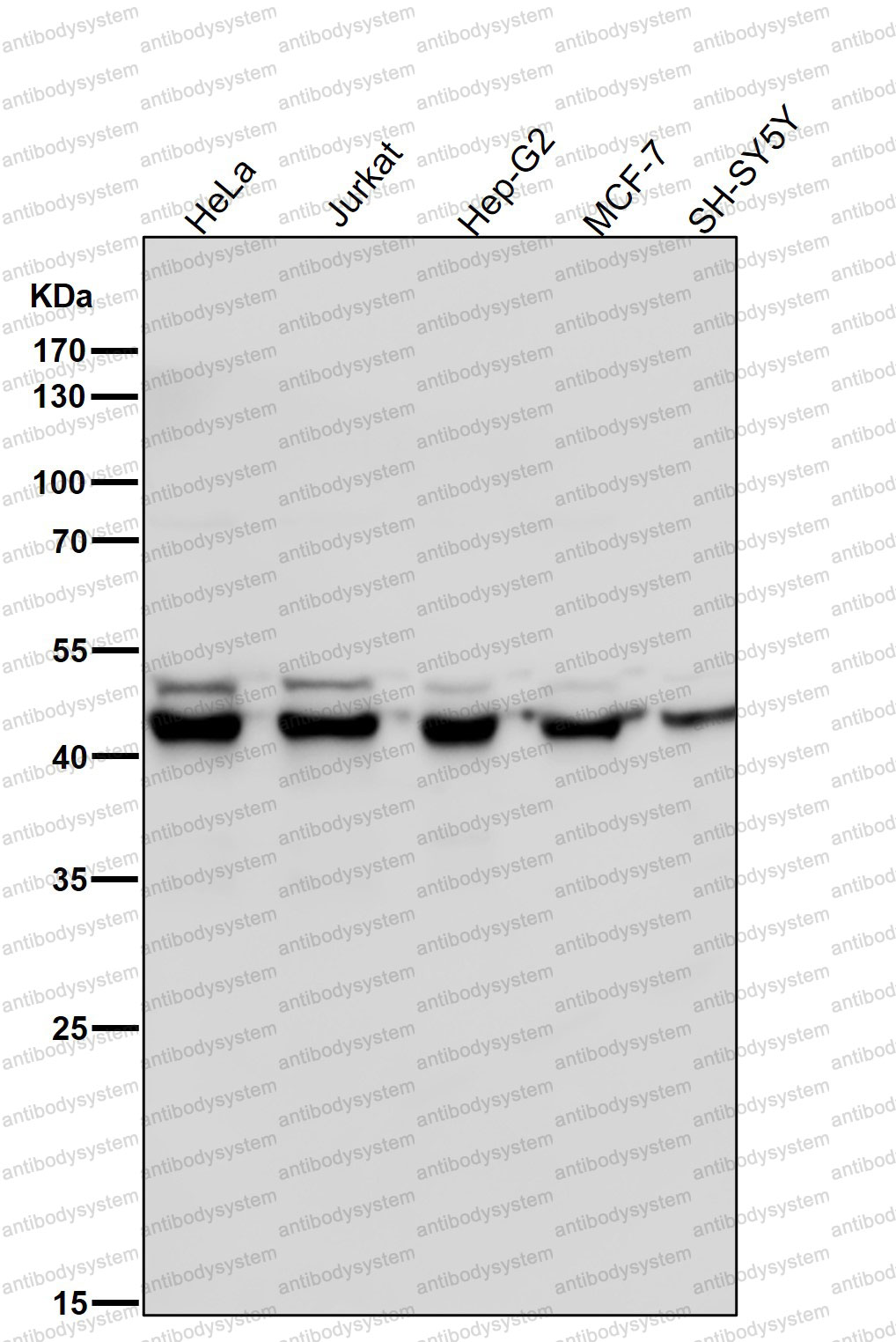Anti-ALKBH1 Antibody (R2E95)_AntibodySystem