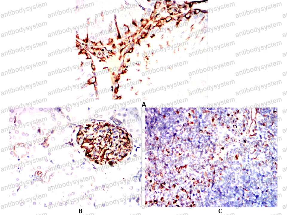 Anti-CD276/B7-H3 Antibody (R3U94)_AntibodySystem