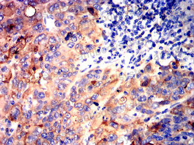Anti-SCARB1/SR-BI/CLA-1/SRB1 Antibody (R3Y43)_AntibodySystem