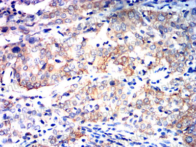 Anti-SIGLEC15/CD33L3 Antibody (R3Y47)_AntibodySystem