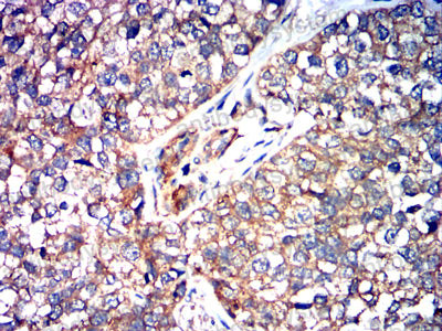 Anti-SIGLEC15/CD33L3 Antibody (R3Y48)_AntibodySystem