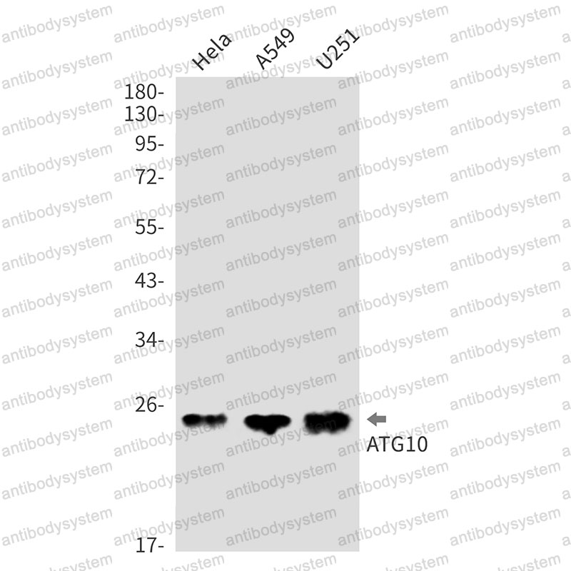Anti-ATG10 Antibody (R2S88)_AntibodySystem