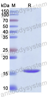 Buy Recombinant Human EMC6 / TMEM93, N-SUMO