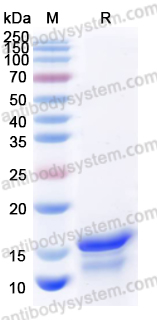 Buy Recombinant Human UTP14A Protein, N-His